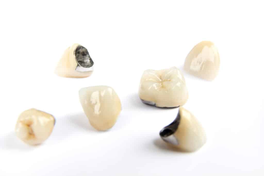 Same-Day Crowns Vs. Traditional Crowns | Hendersonville Family Dental